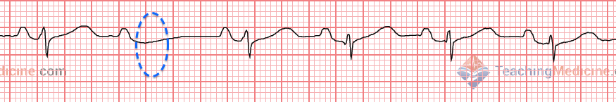 Teaching Medicine - Tutorial: Analyze the Waveforms